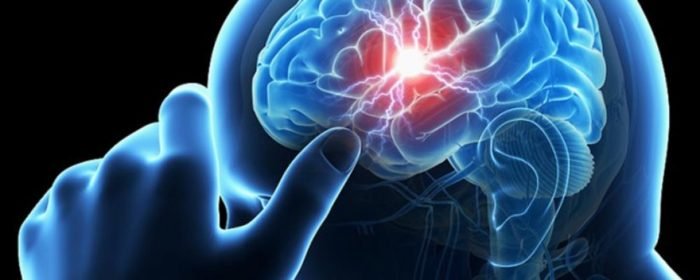 Παπαδοπούλου Βιολέττα | Επιληψια